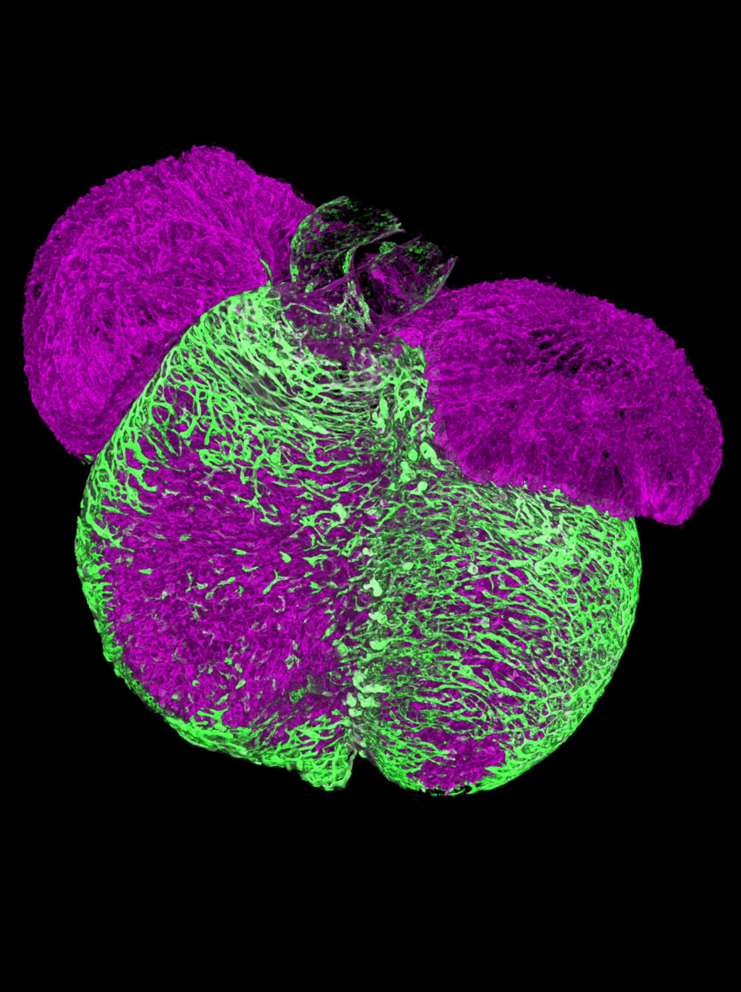 Embryonic Mouse Heart [image] Eurekalert Science News Releases